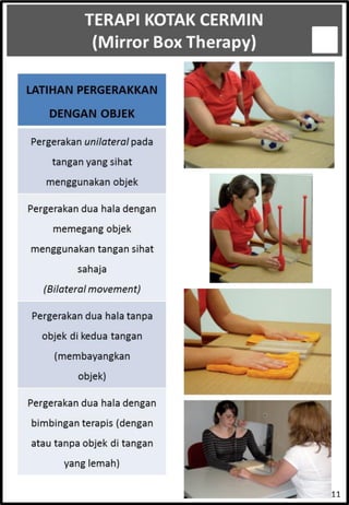 Upper limb rehabilitation 1 | PDF