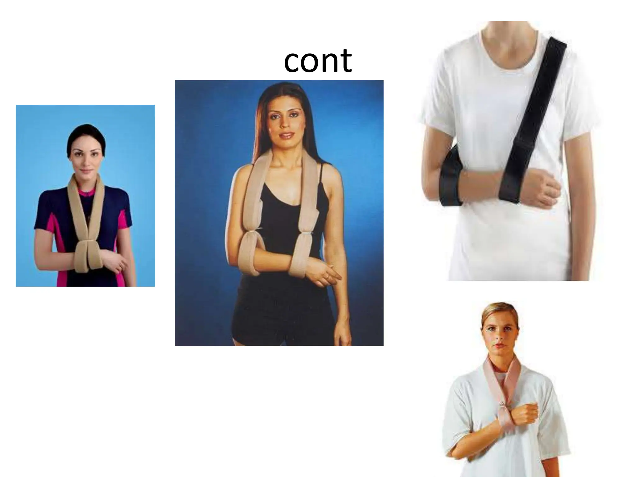 Upper limb slabs, broad arm sling and.pptx