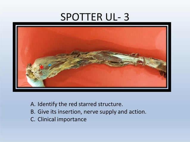 UPPER_LIMB spotters book anatomy notes slides documented by sk | PDF ...