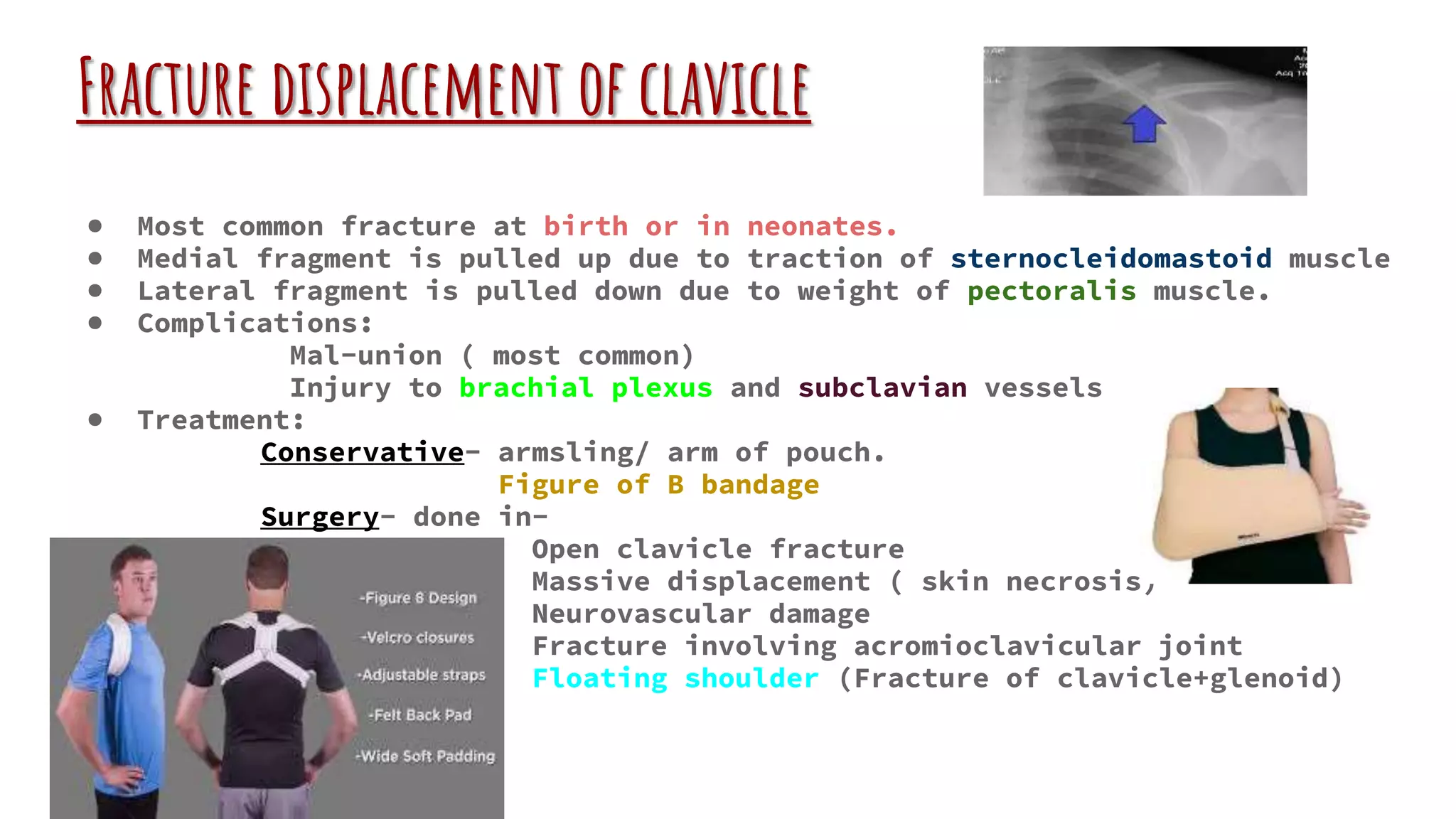 Upper limb trauma ( clavicle & shoulder fracture) | PPT