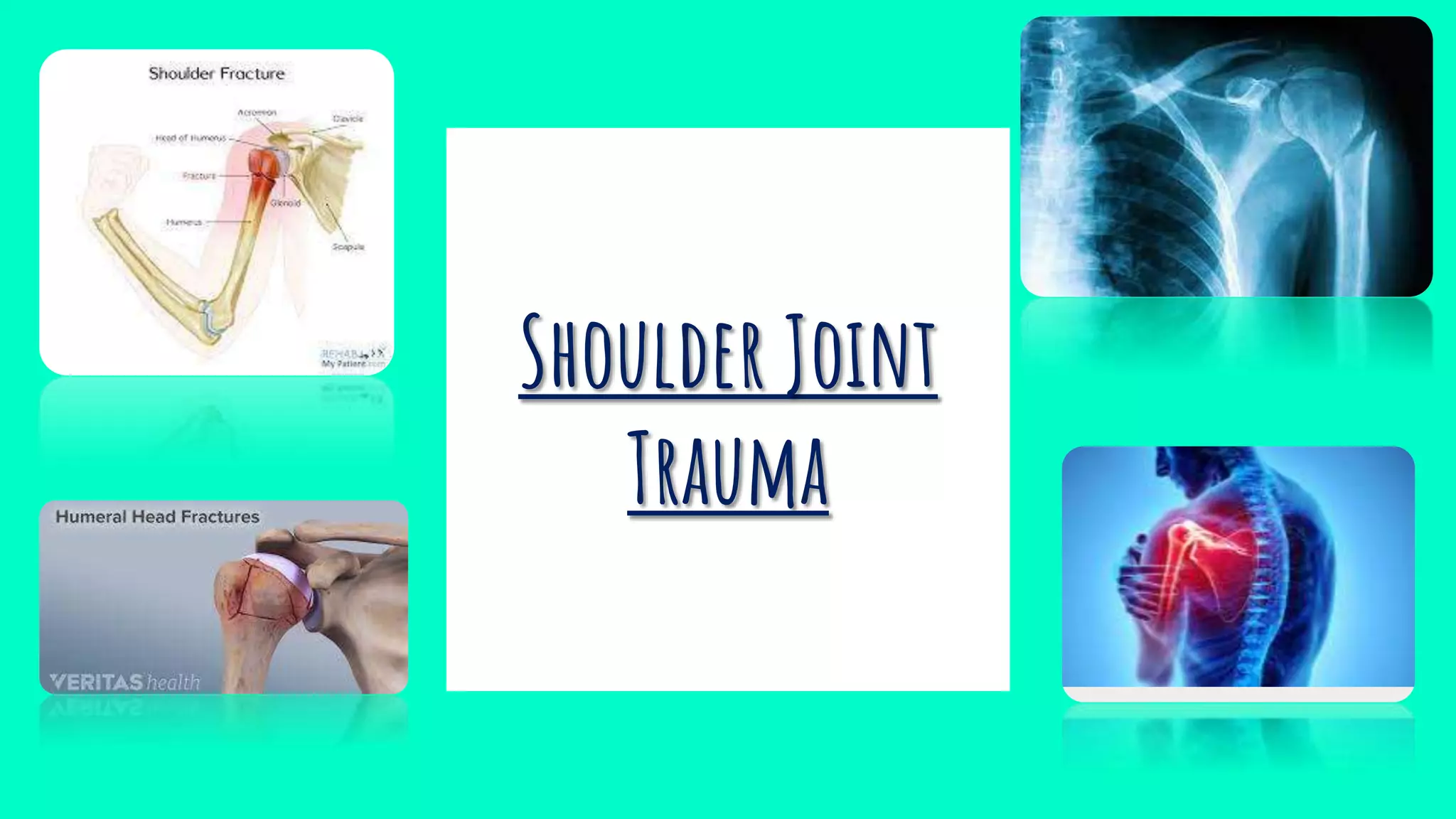 Upper limb trauma ( clavicle & shoulder fracture) | PPT
