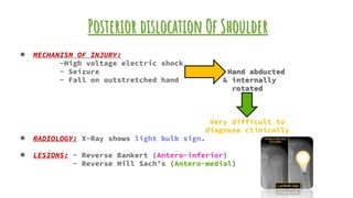 Upper limb trauma ( clavicle & shoulder fracture) | PPT