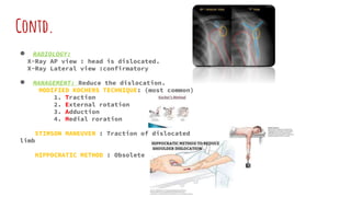 Upper limb trauma ( clavicle & shoulder fracture) | PPT