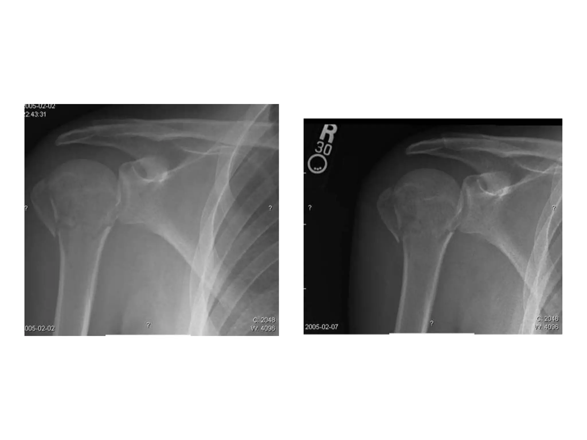 upper limb trauma.pptx