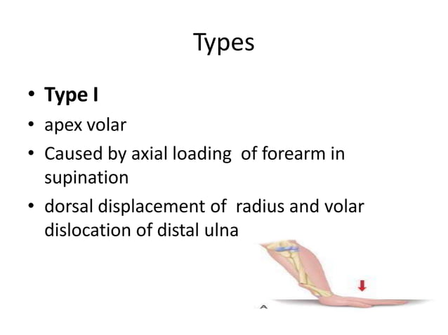 upper limb trauma.pptx