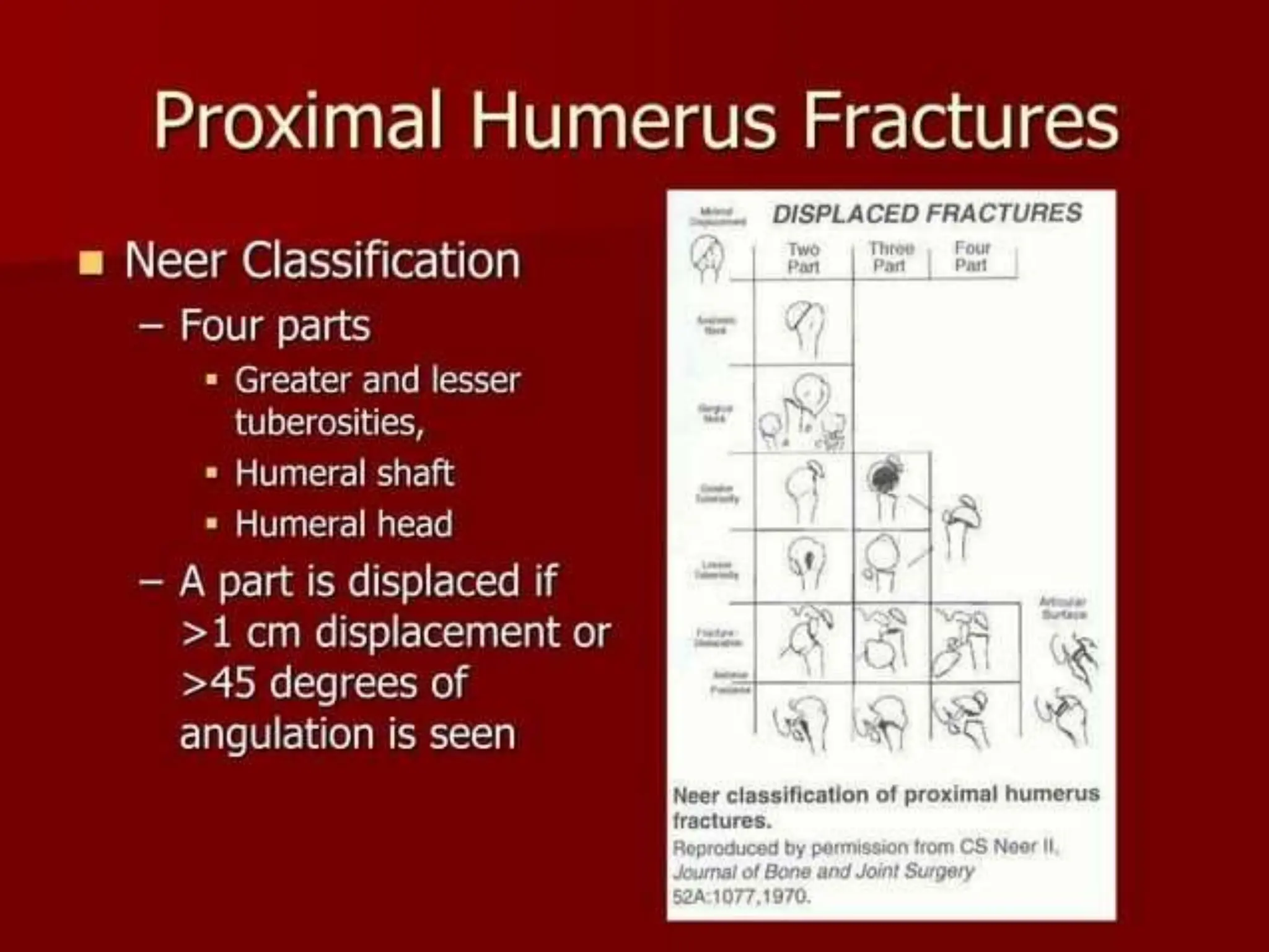 upper limb trauma.pptx