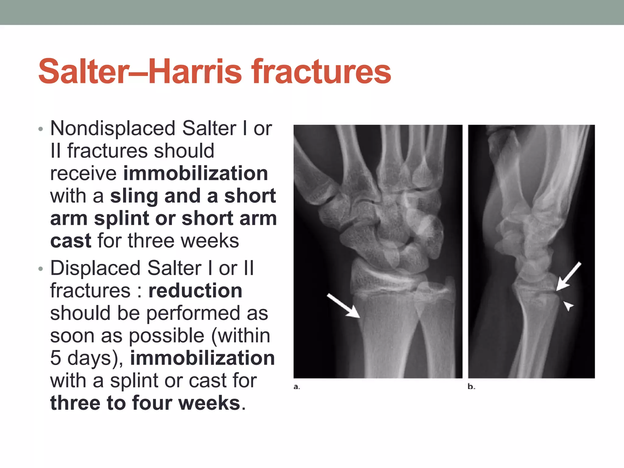Upper limb trauma part 2 | PPTX