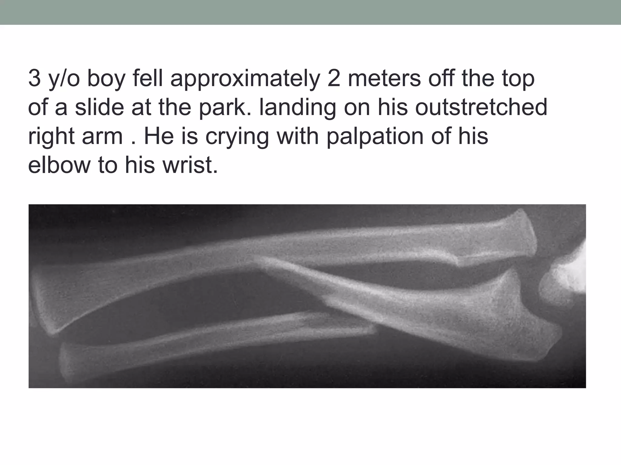 Upper limb trauma part 2 | PPTX