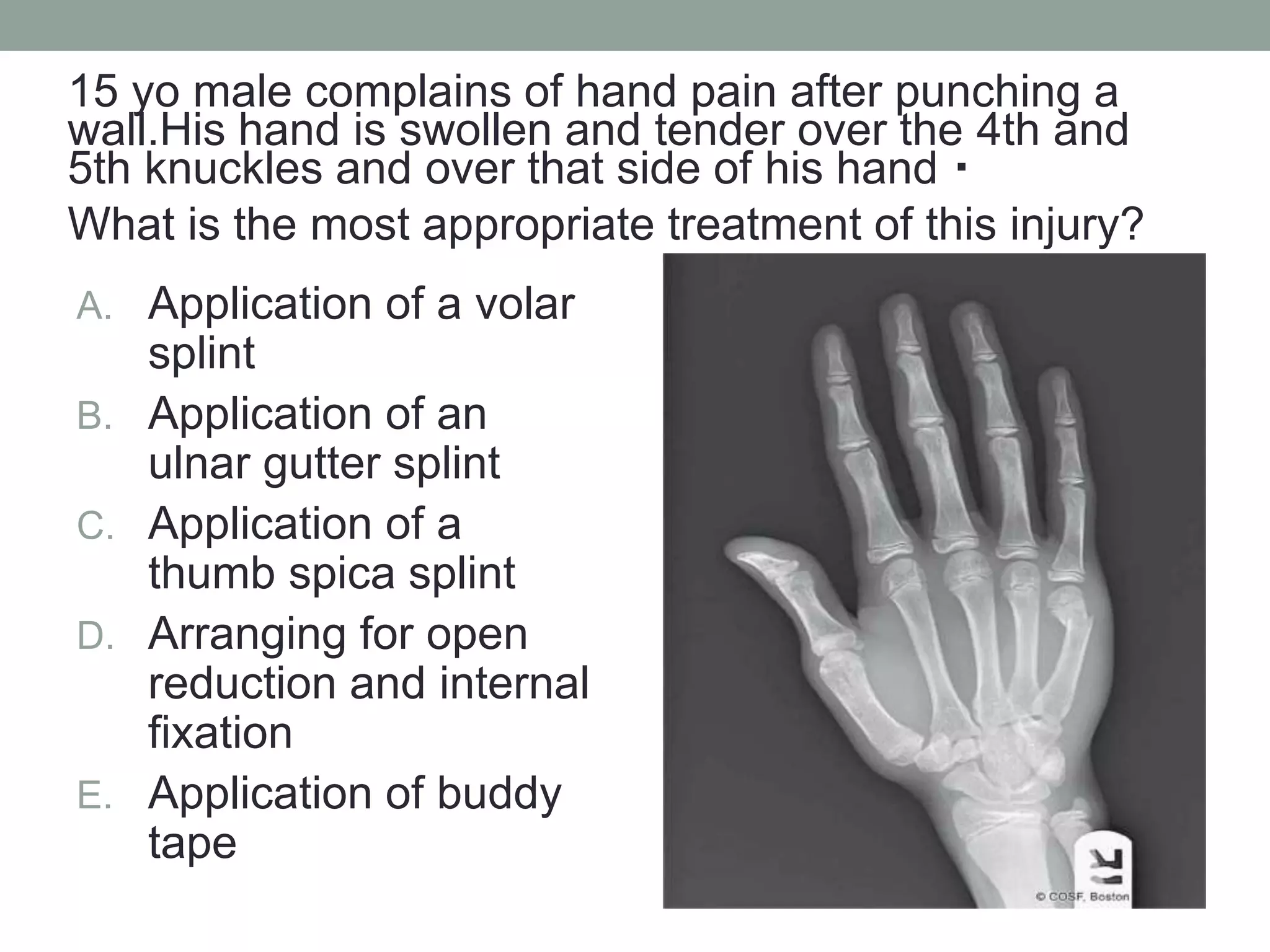 Upper limb trauma part 2 | PPTX | Death, Injury, or Military Conflict ...