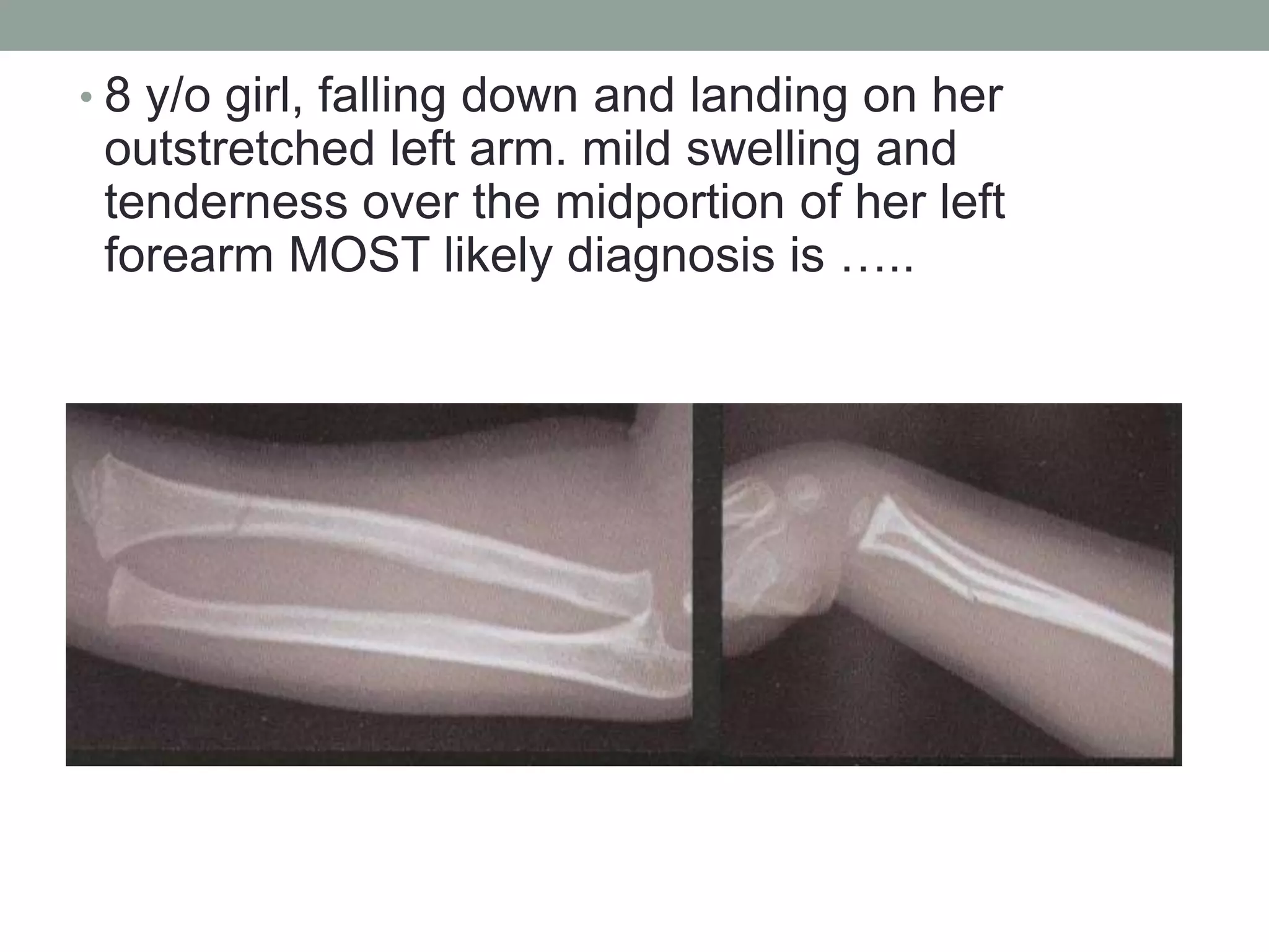 Upper limb trauma part 2 | PPTX