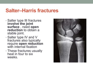 Upper limb trauma part 2 | PPTX