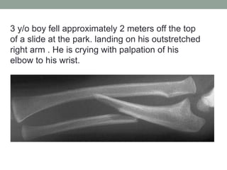Upper limb trauma part 2 | PPTX