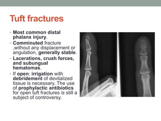 Upper limb trauma part 2 | PPTX