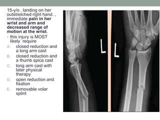 Upper limb trauma part 2 | PPTX