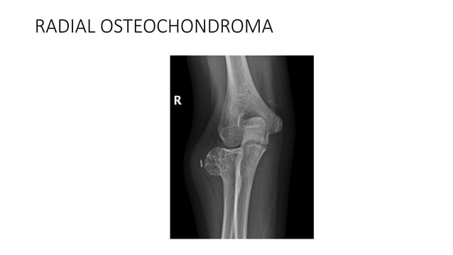 UPPER LIMB XRAY PATHOLOGIES and xray technicques.pptx