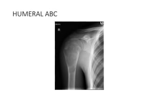 UPPER LIMB XRAY PATHOLOGIES and xray technicques.pptx