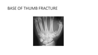 UPPER LIMB XRAY PATHOLOGIES and xray technicques.pptx