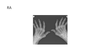 UPPER LIMB XRAY PATHOLOGIES and xray technicques.pptx