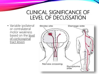 Upper and Lower motor neuron lesions | PPTX