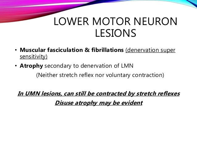 Upper & lower motor neuron lesions