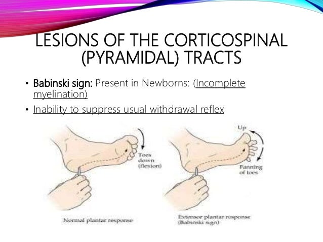 Upper & lower motor neuron lesions