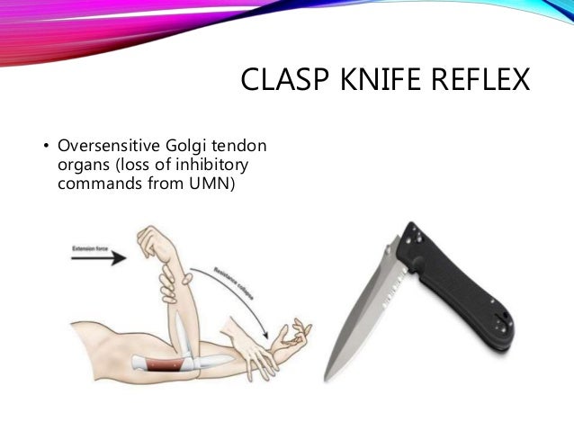 Upper and Lower motor neuron lesions
