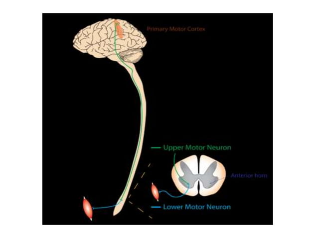 Upper & Lower Motor Neuron Lesions.pptx