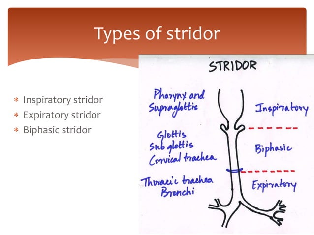 PEDIATRIC: Upper respiratory tract infectionS in children: SINUSITIS ...
