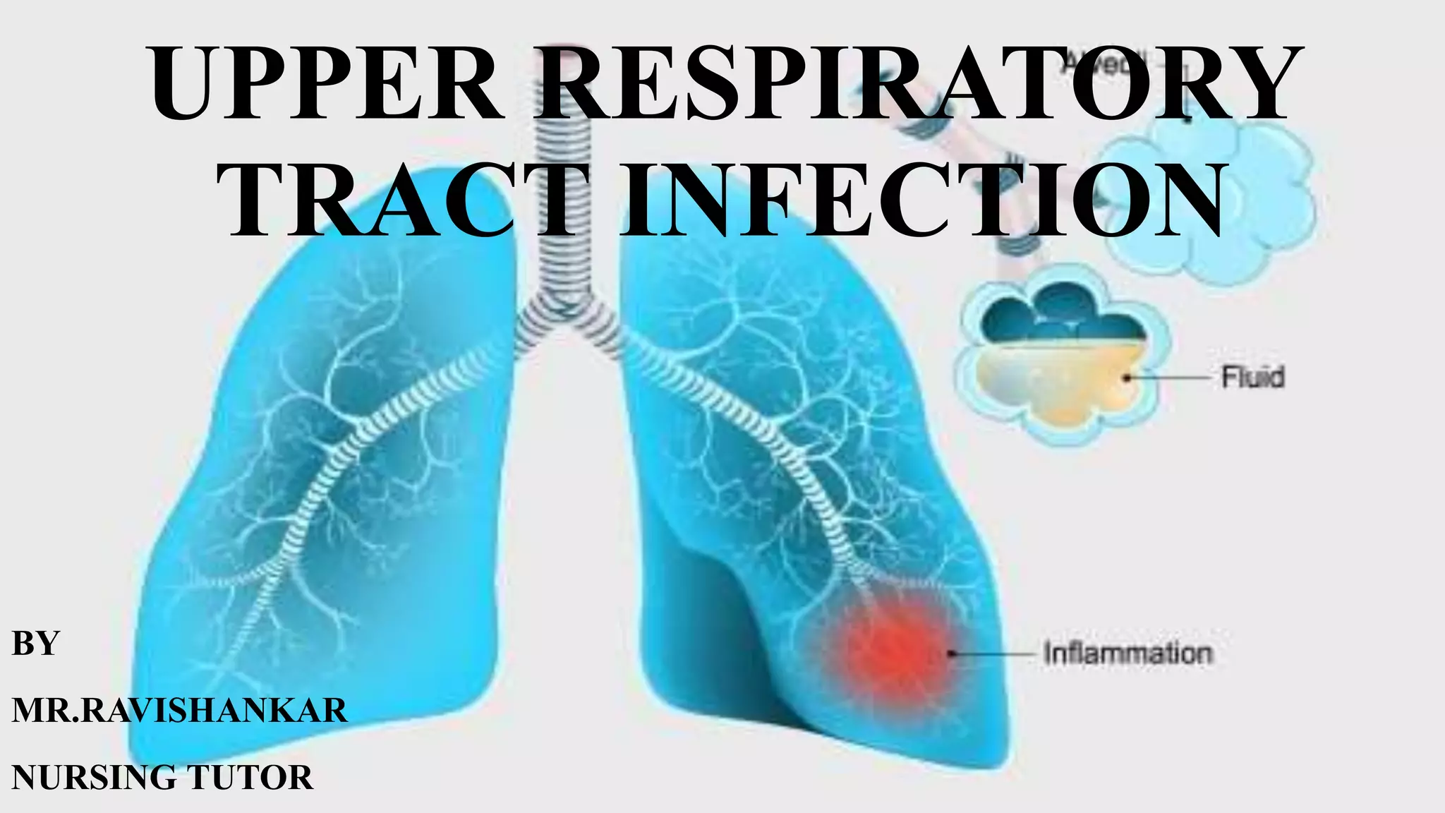Upper respiratory tract infection.pptx