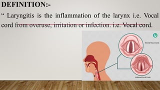 Upper respiratory tract infection.pptx