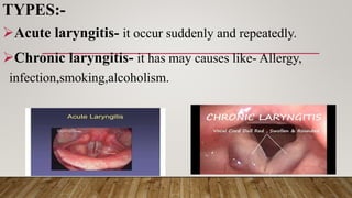 Upper respiratory tract infection.pptx