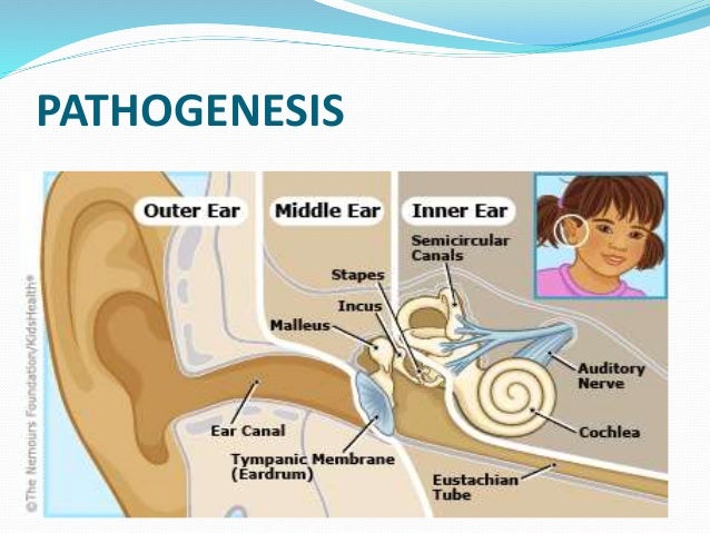 Upper respiratory tract infection & otitis media