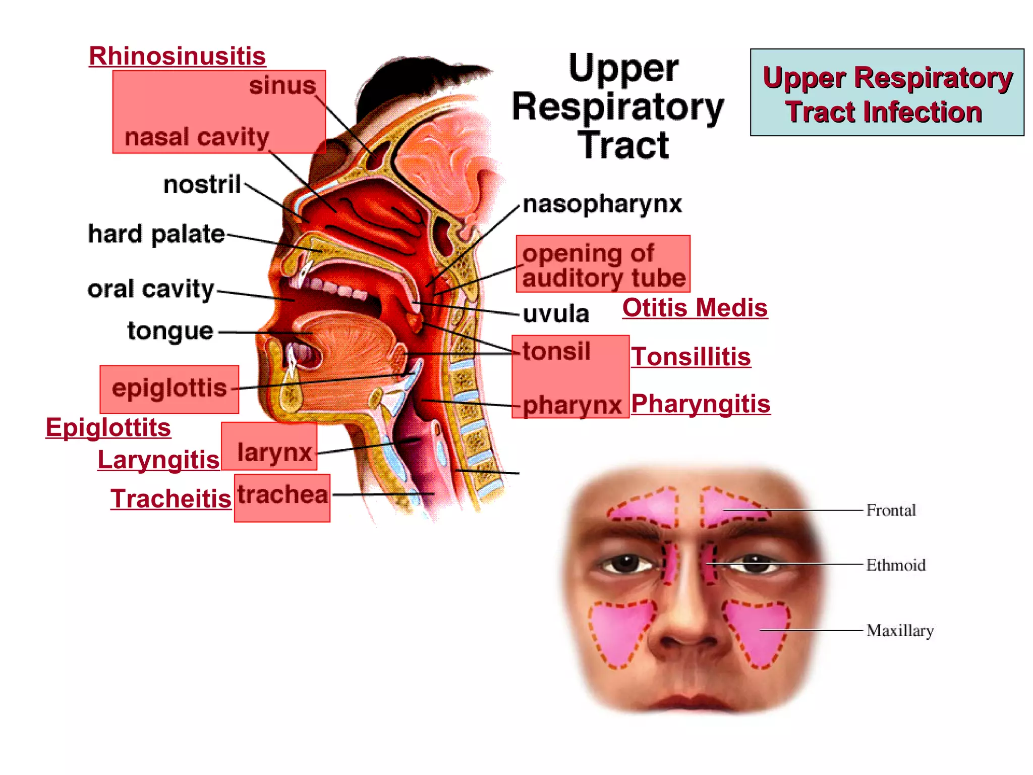 7 Upper respiratory tract infections | PPT