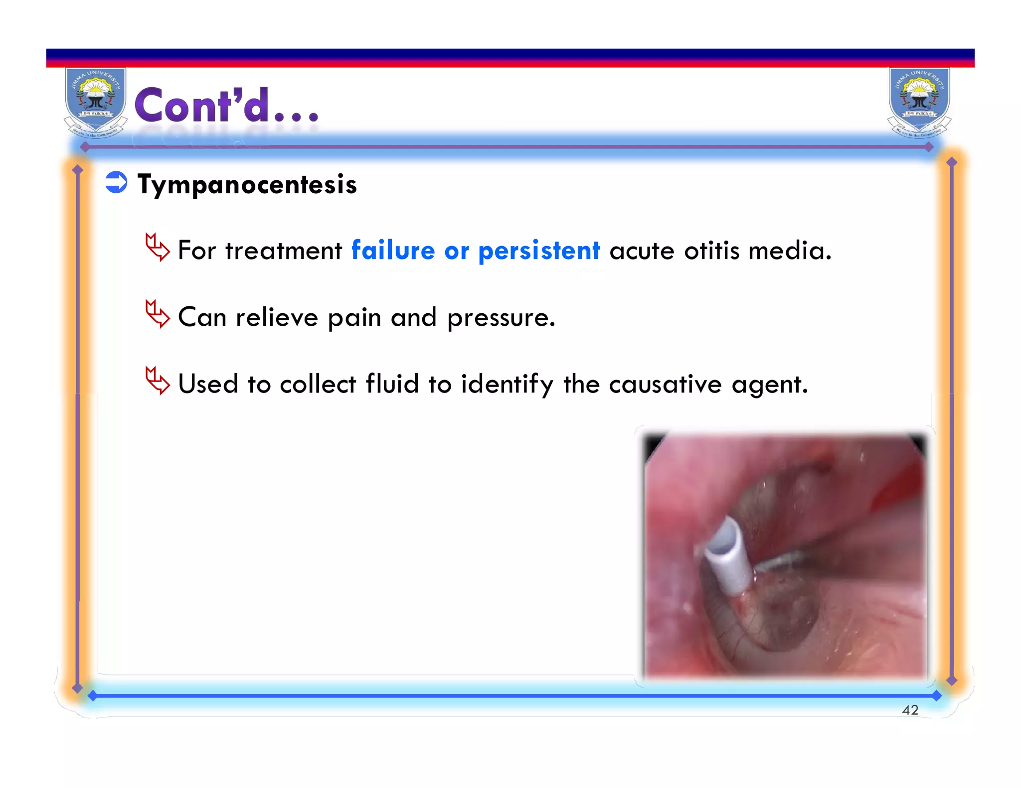 Pharmacotherapy of Upper respiratory tract infections | PDF