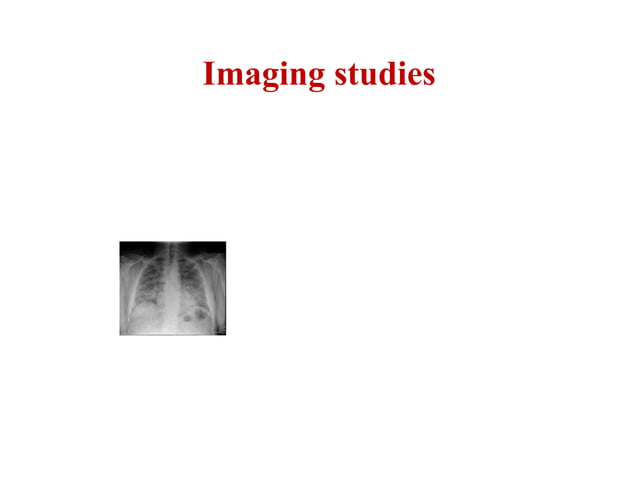 Upper Respiratory Tract Infections Ppt Pptx