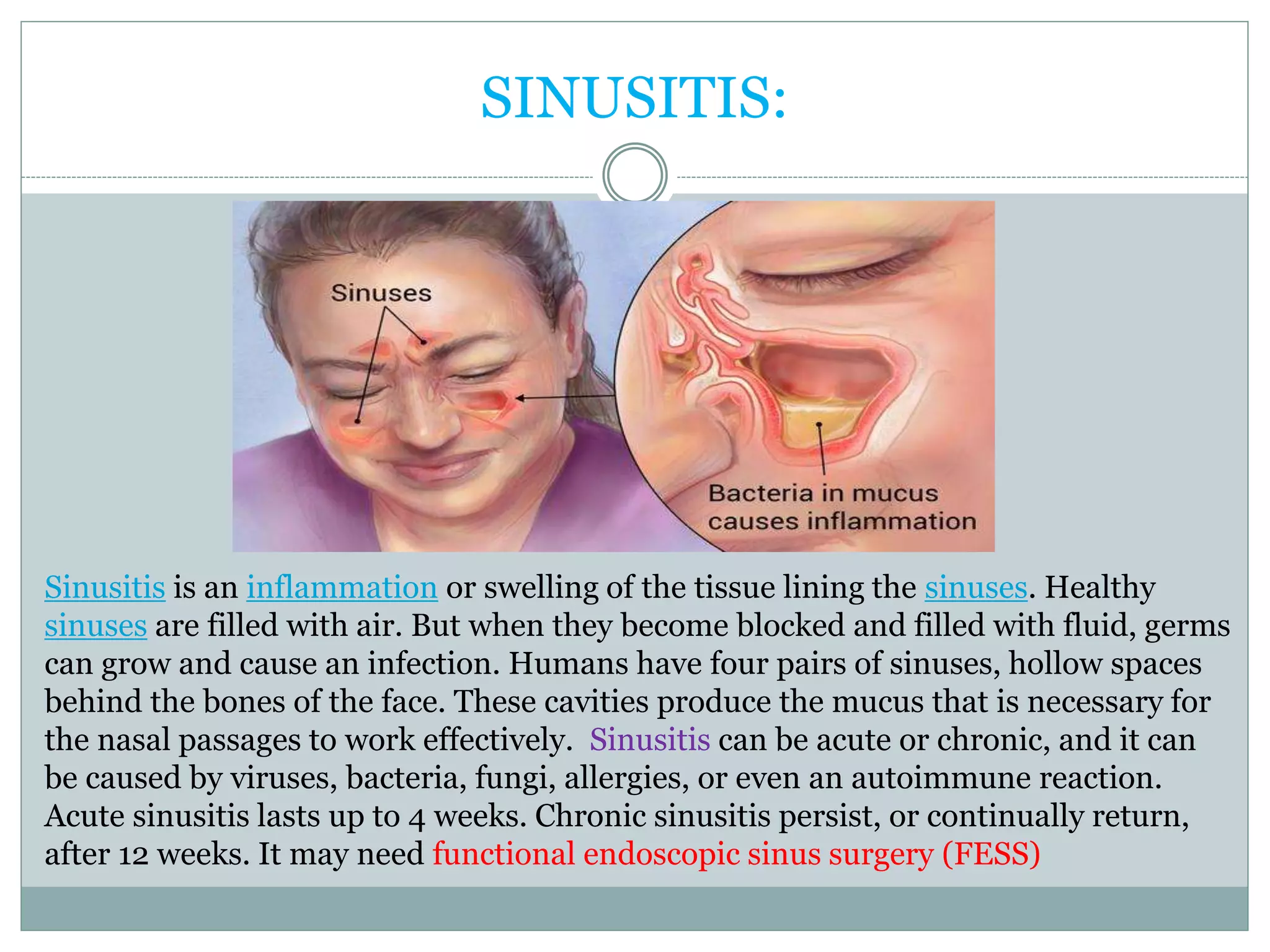 Upper respiratory tract infections | PPTX