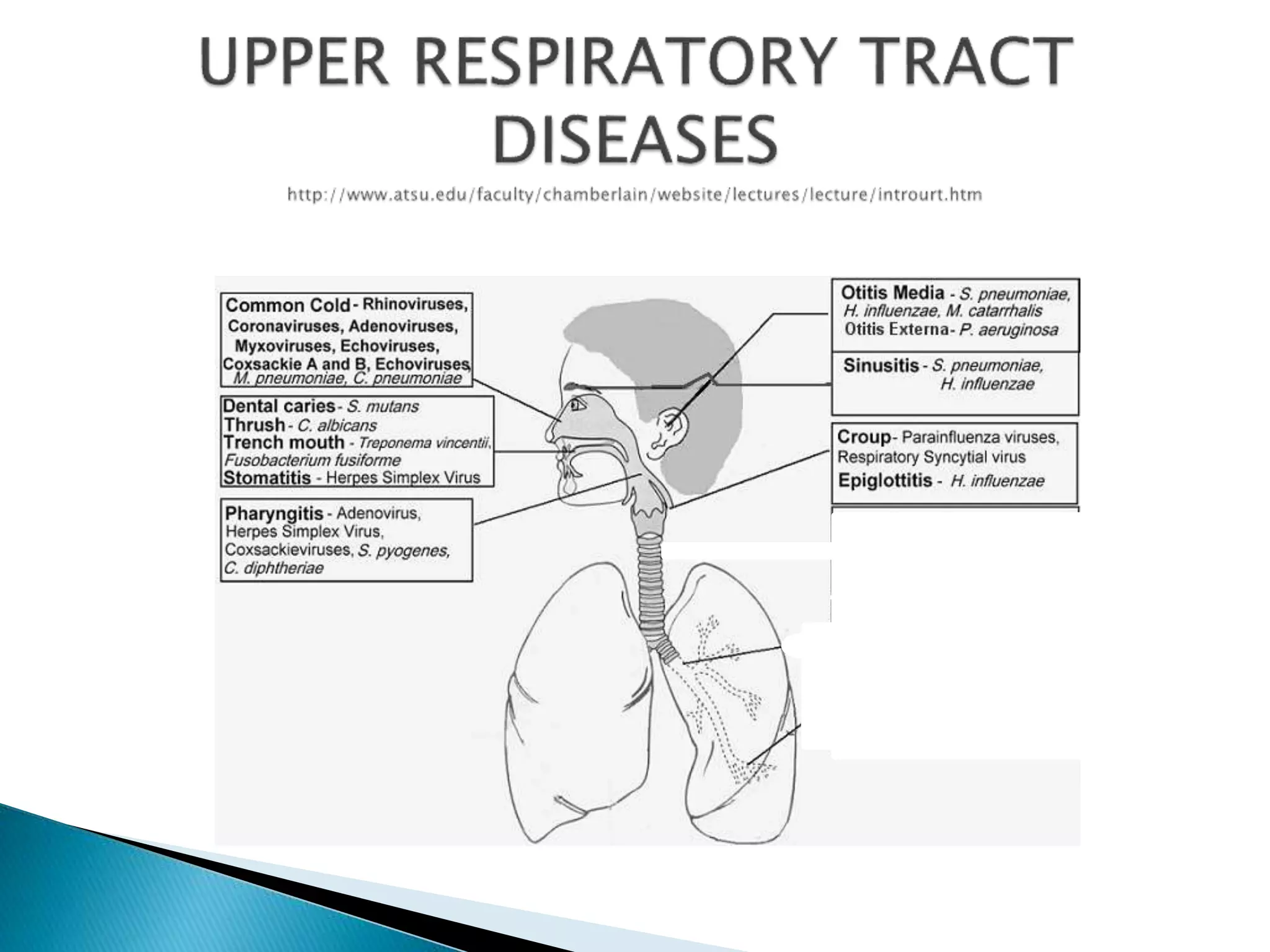Upper respiratory infections | PPTX