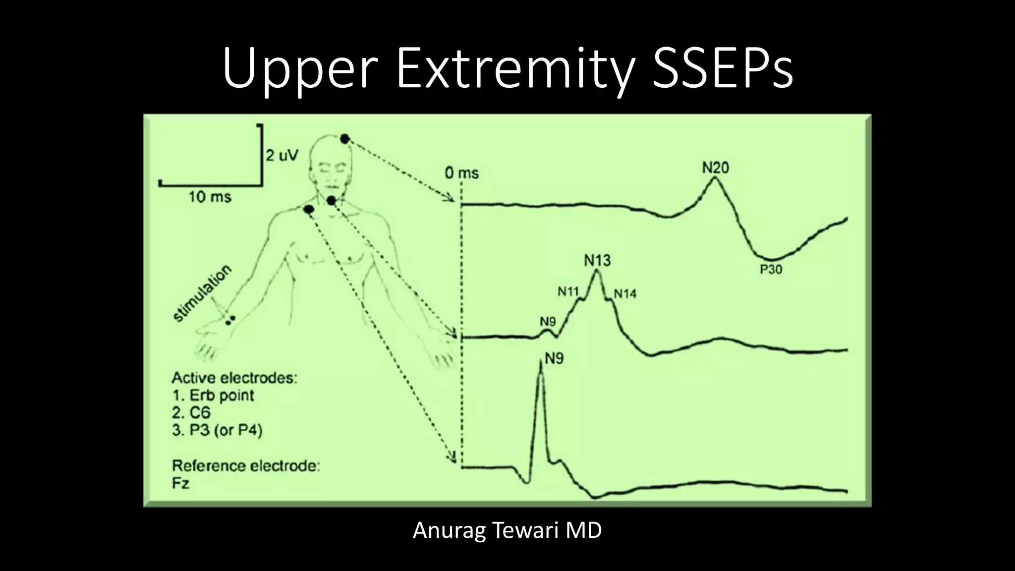 Upper Extremity Somatosensory Evoked Potential (Upper SSEP) | PPTX