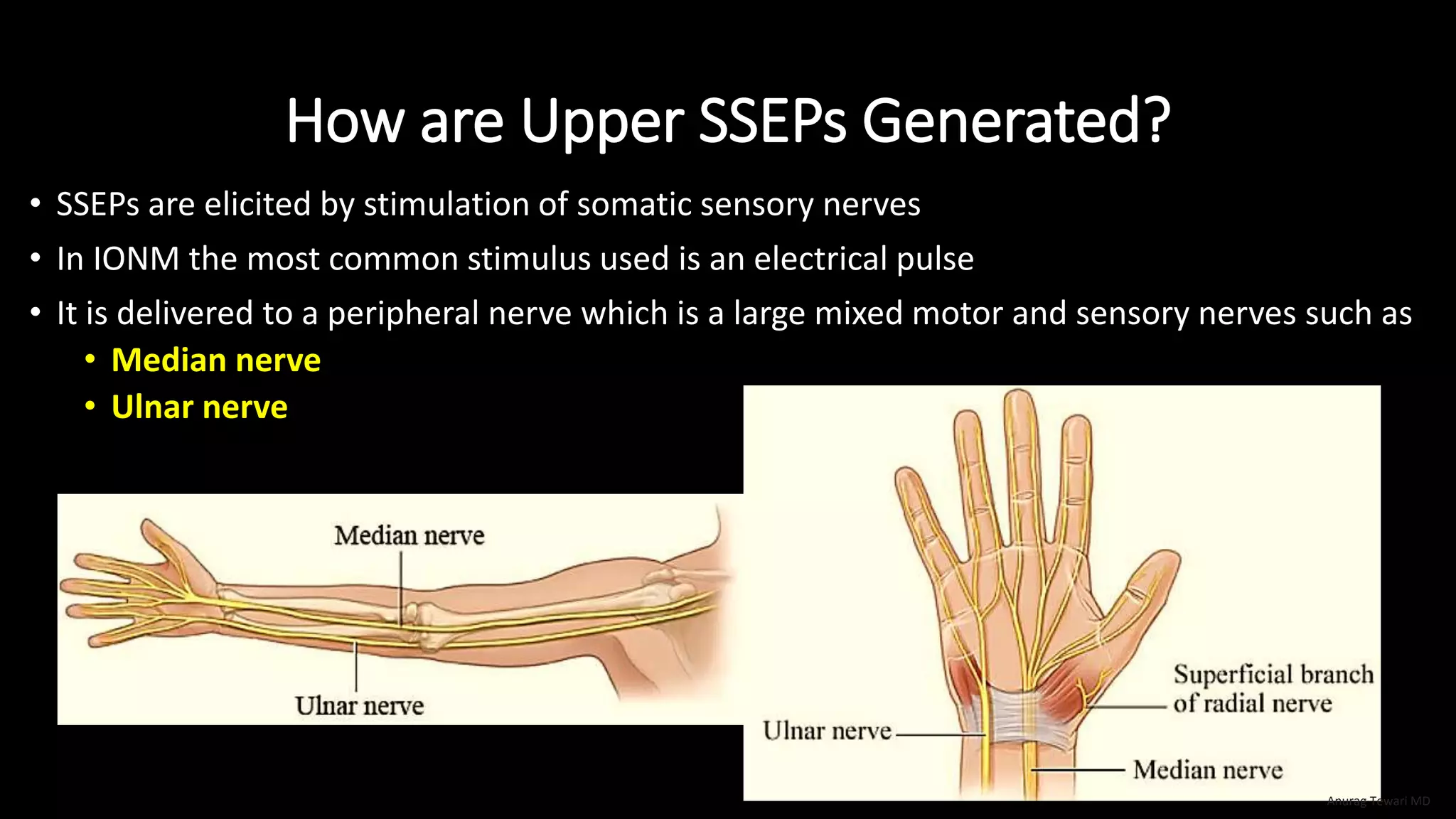 Upper Extremity Somatosensory Evoked Potential (Upper SSEP) | PPTX