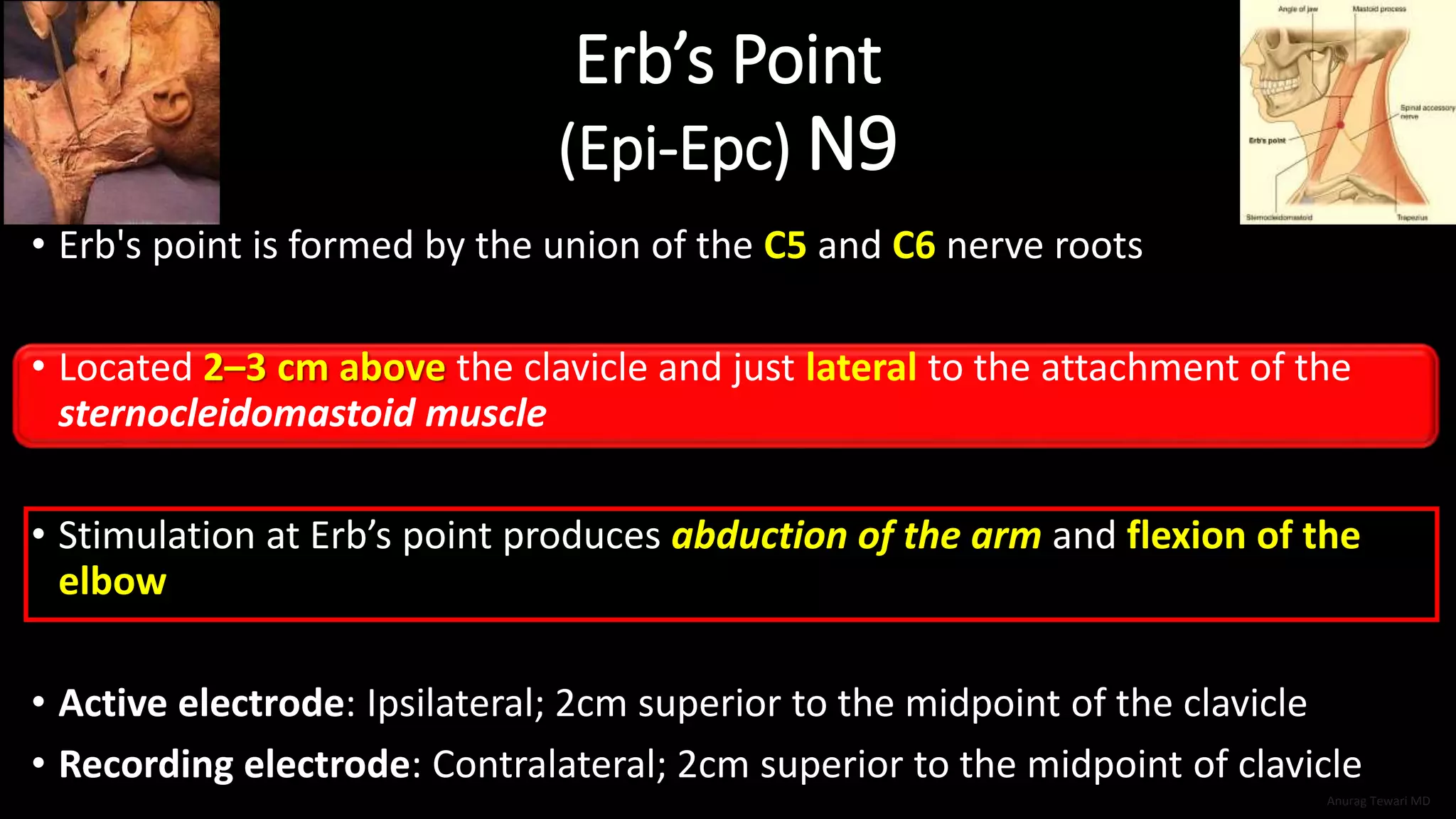 Upper Extremity Somatosensory Evoked Potential (Upper SSEP) | PPTX
