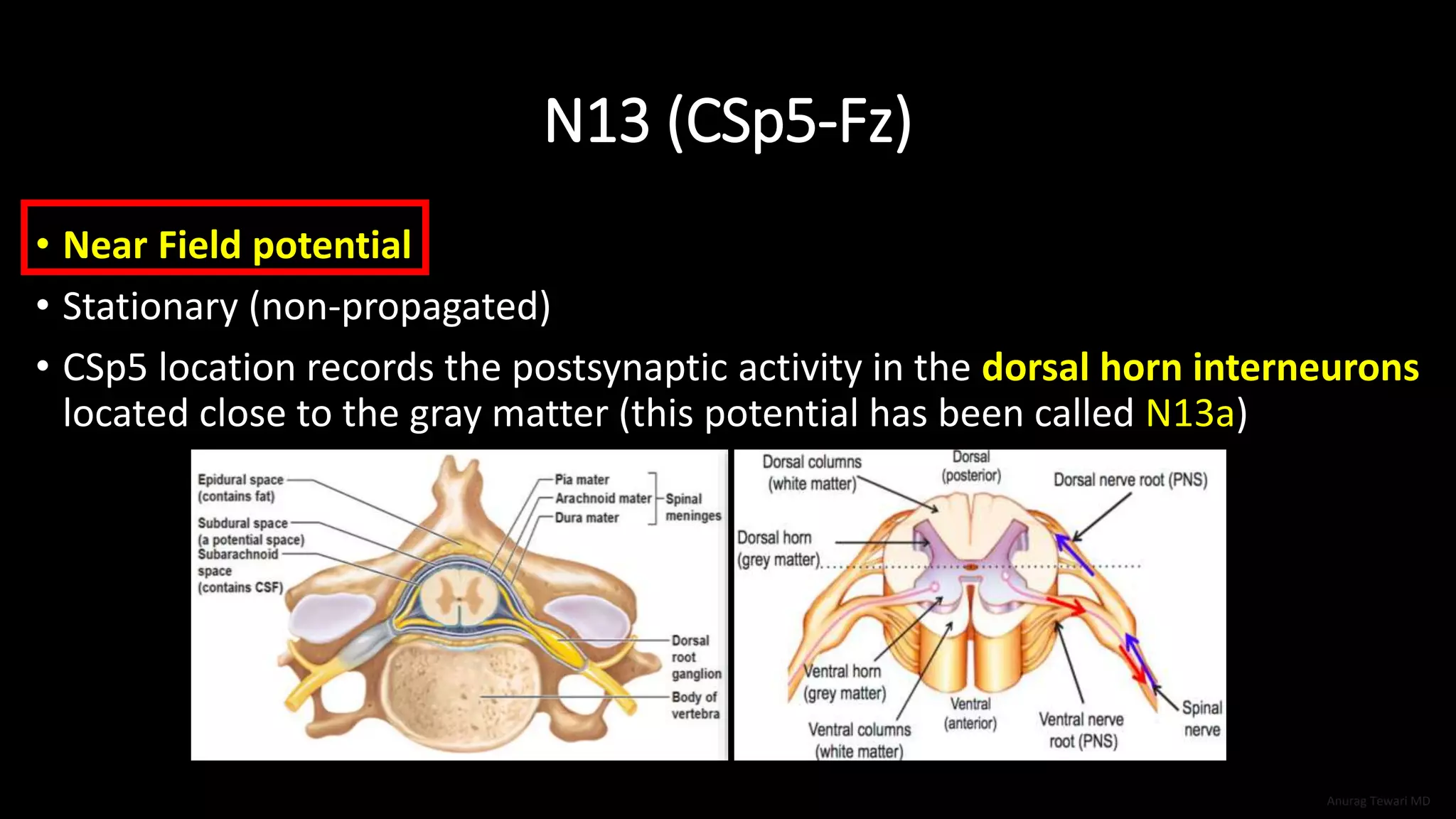 Upper Extremity Somatosensory Evoked Potential (Upper SSEP) | PPTX