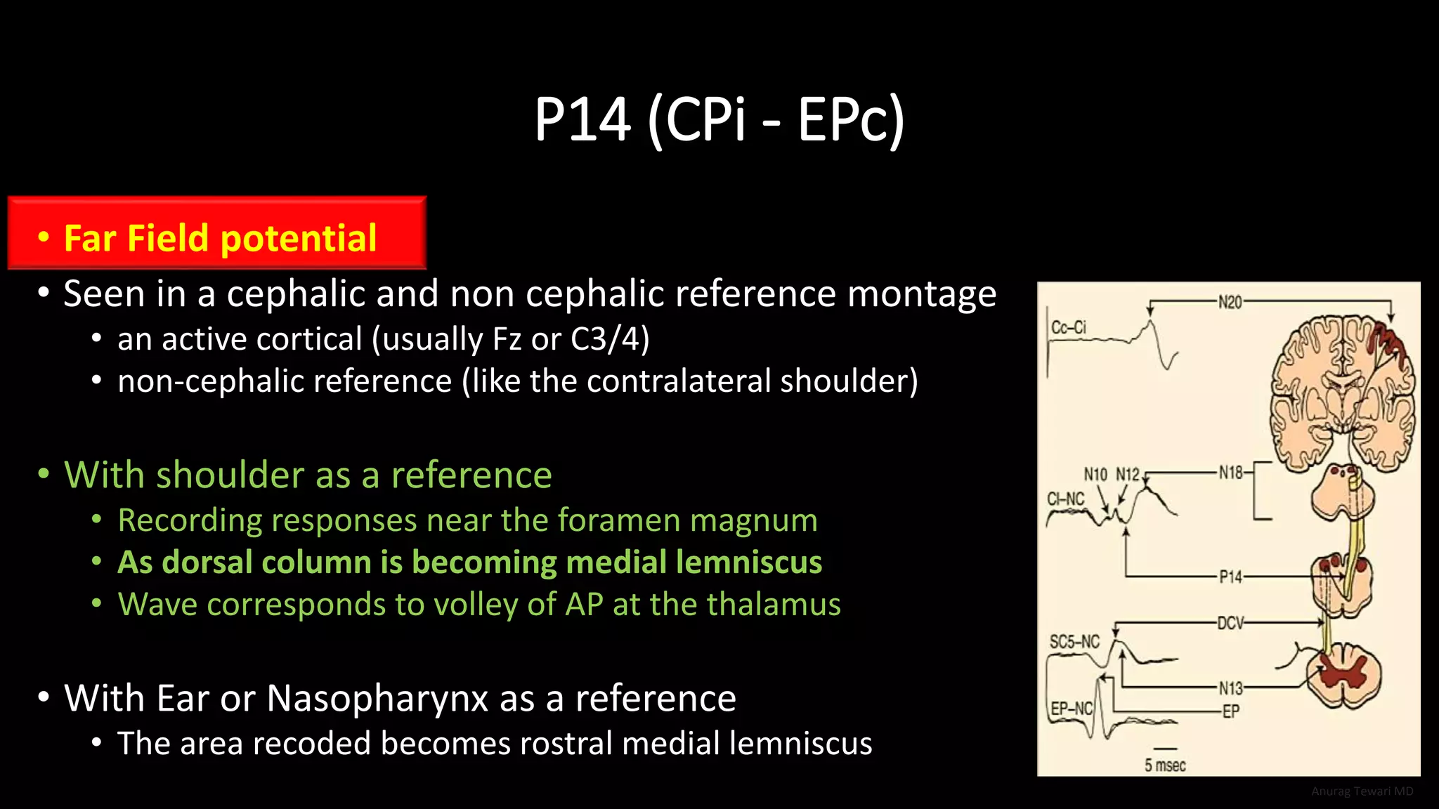Upper Extremity Somatosensory Evoked Potential (Upper SSEP) | PPTX