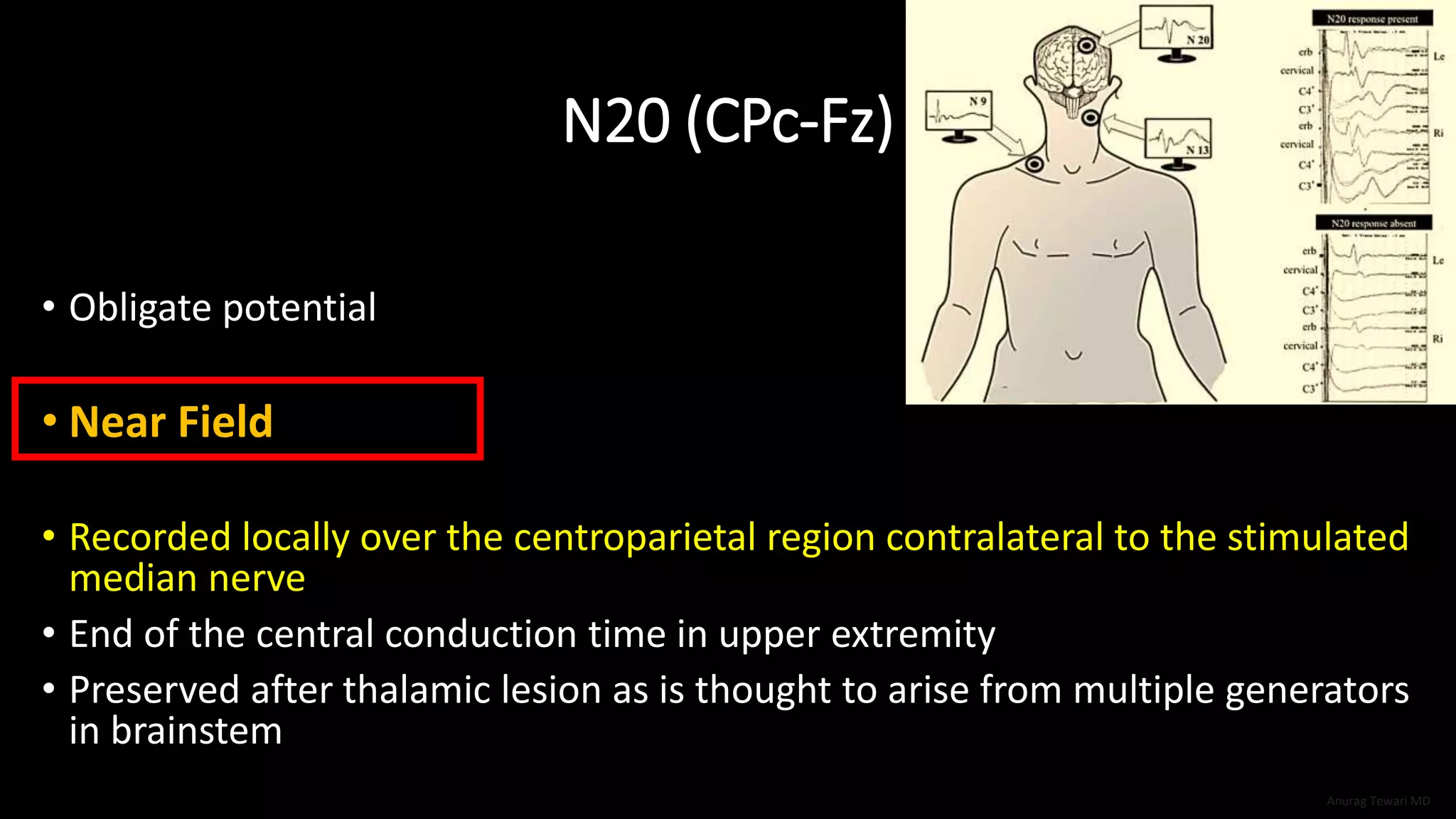 Upper Extremity Somatosensory Evoked Potential (Upper SSEP) | PPTX