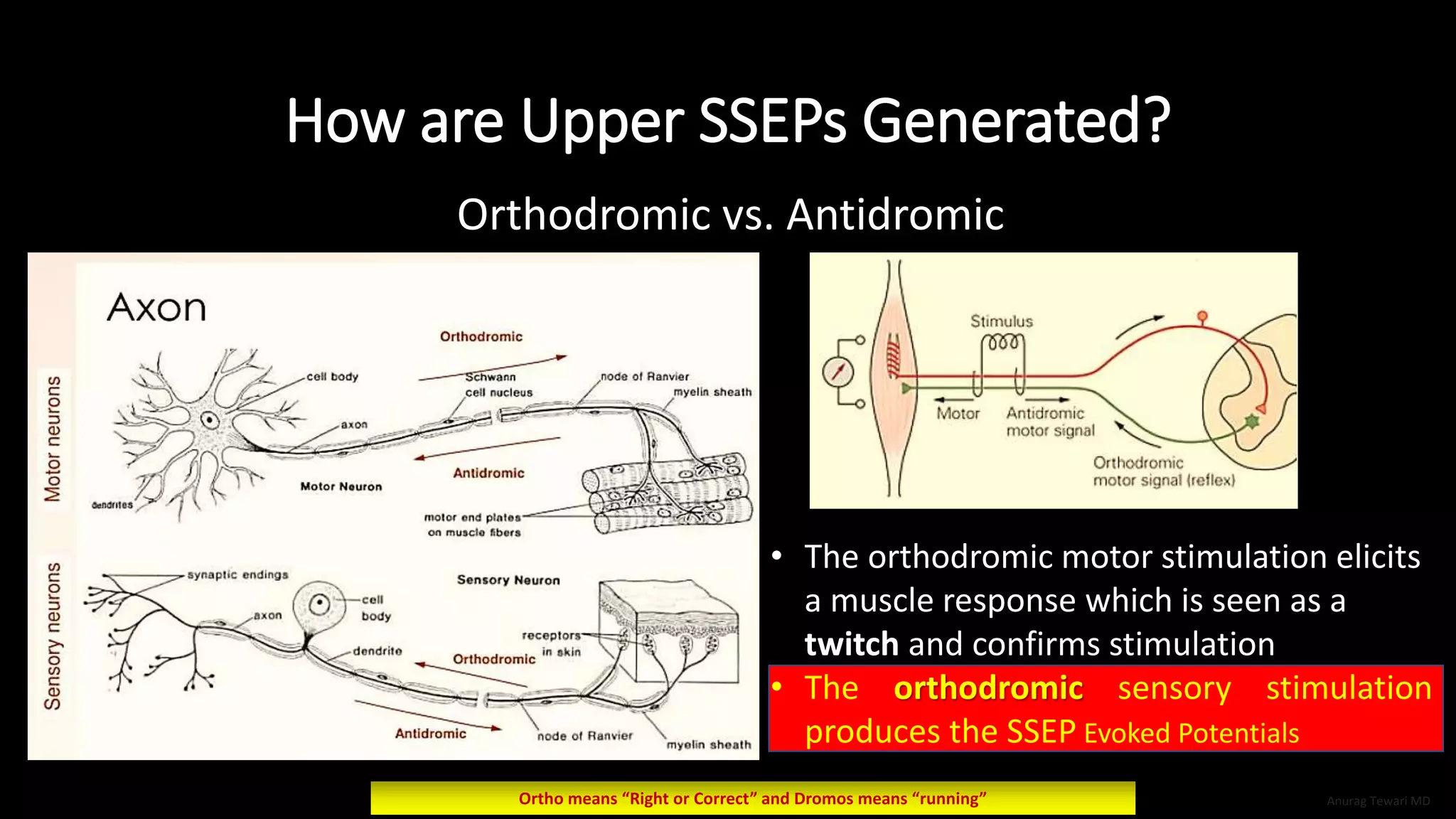 Upper Extremity Somatosensory Evoked Potential (Upper SSEP) | PPTX