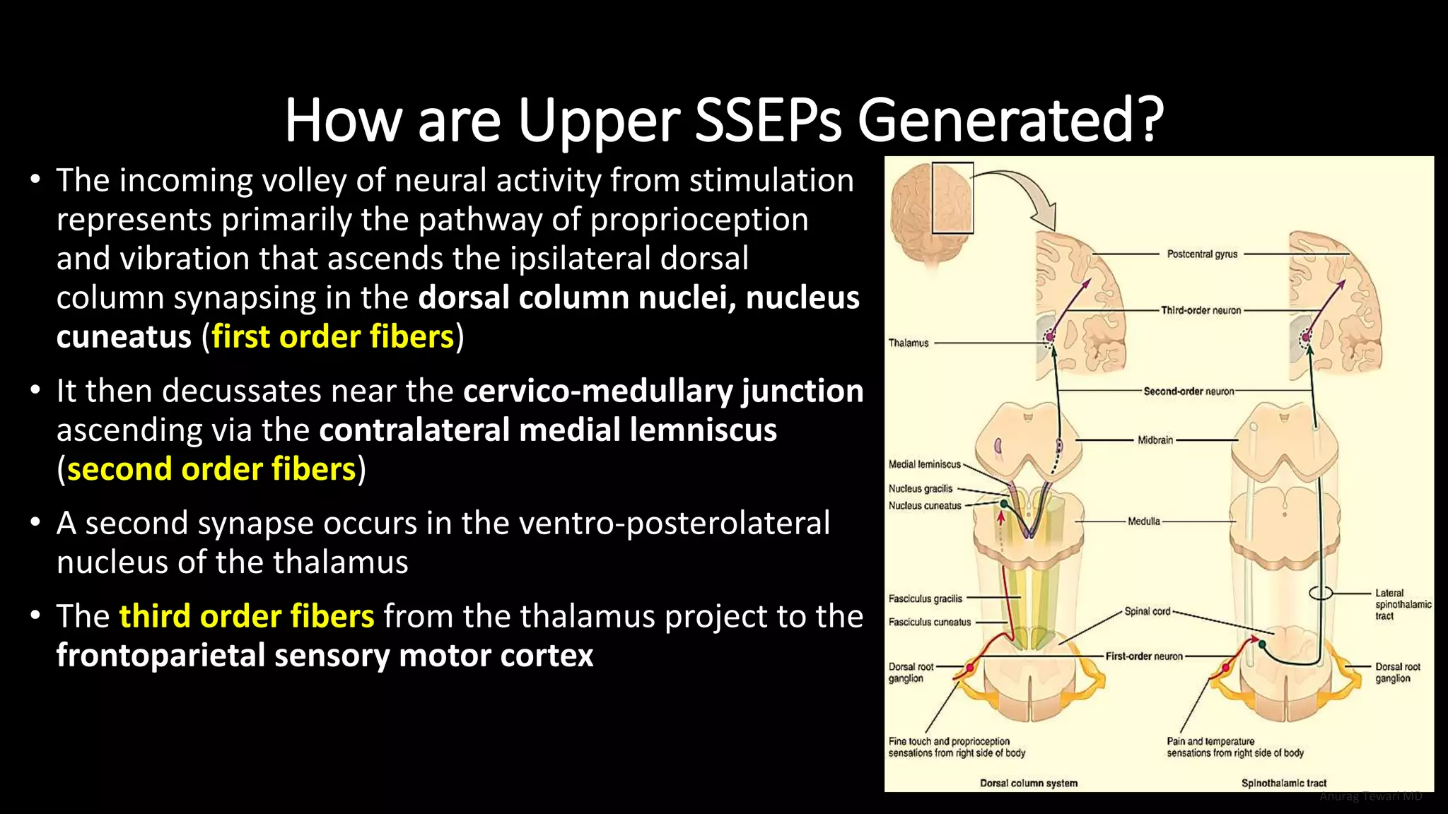 Upper Extremity Somatosensory Evoked Potential (Upper SSEP) | PPTX