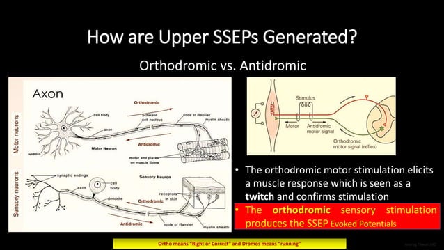 Upper Extremity Somatosensory Evoked Potential (Upper SSEP) | PPTX ...