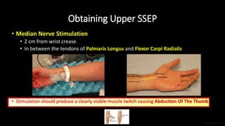 Upper Extremity Somatosensory Evoked Potential (Upper SSEP) | PPT