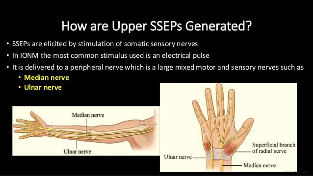 Upper Extremity Somatosensory Evoked Potential (Upper SSEP)