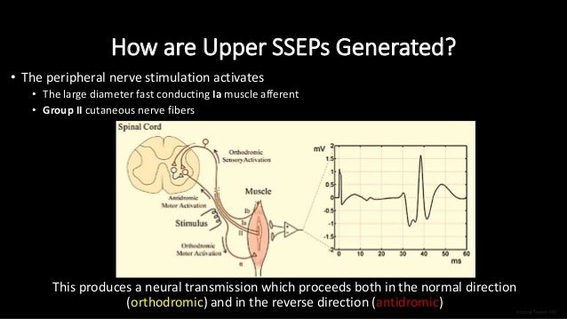 Upper Extremity Somatosensory Evoked Potential (Upper SSEP)