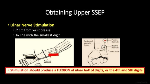 Upper Extremity Somatosensory Evoked Potential (Upper SSEP)